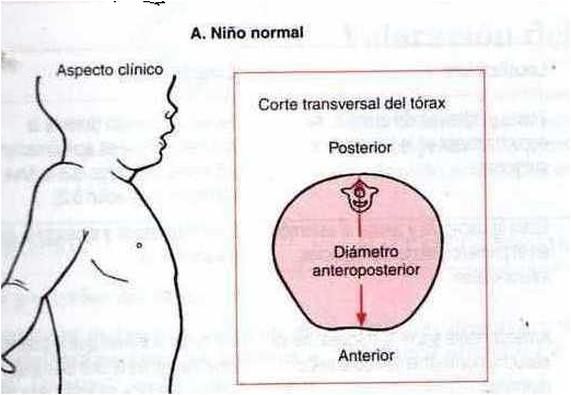 Enfermería Básica UCV : — TORAX ANTEROPOSTERIOR