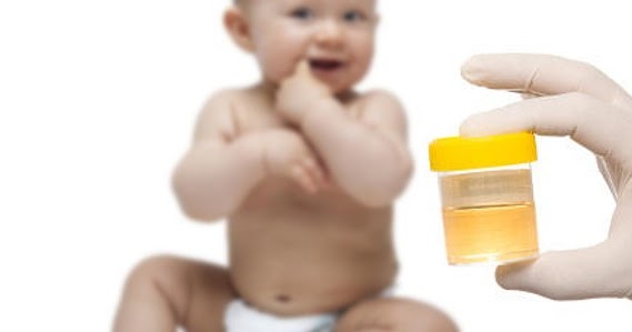 RR's Paediatric Nursing: NONINVASIVE STRATEGY FOR OBTAIN A CLEAN-CATCH ...