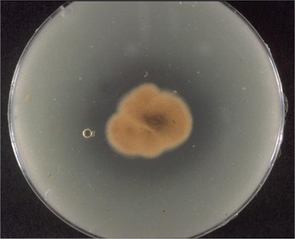 Microbiología y Epidemiología: Emericella nidulans