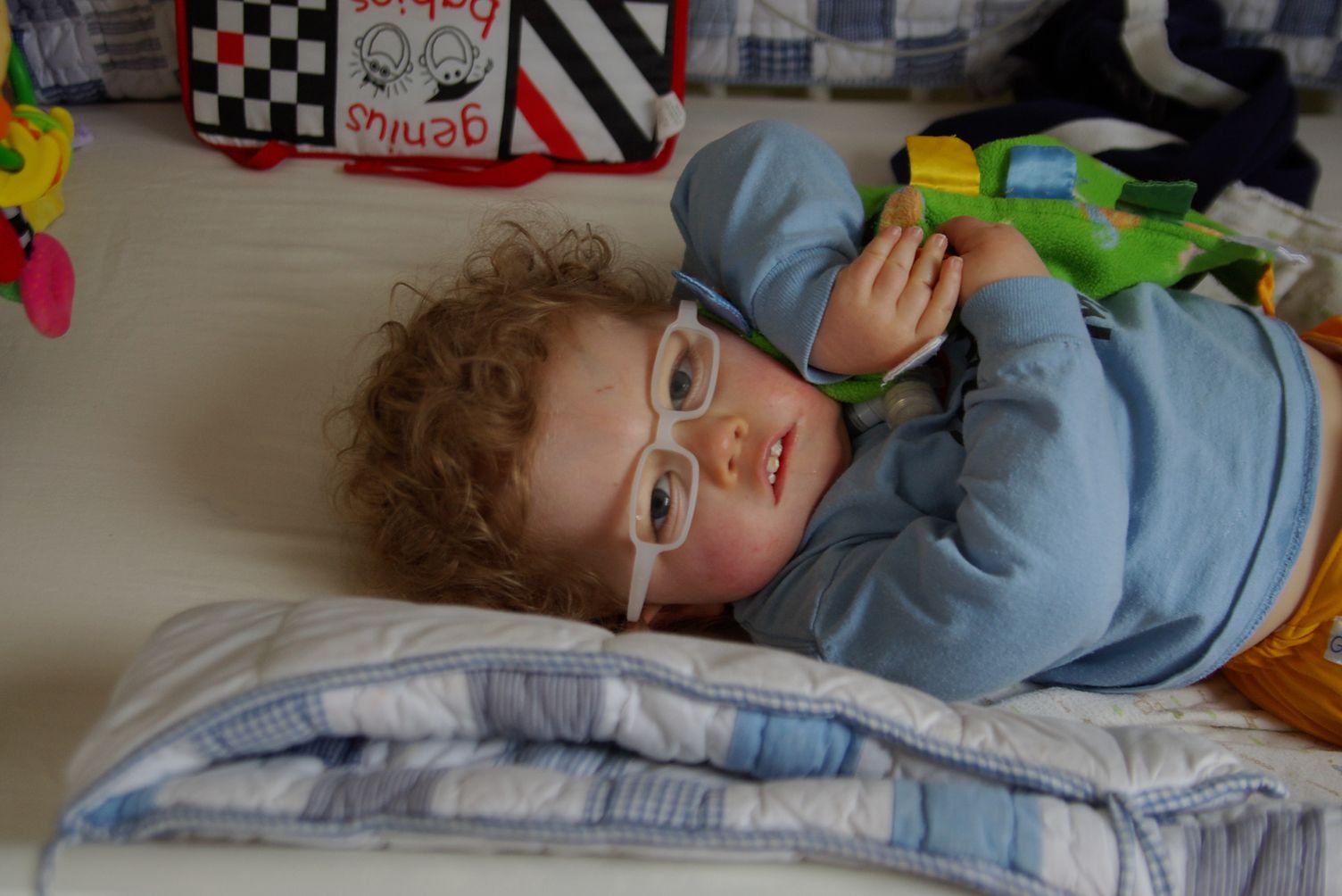 Moebius Syndrome and Our Family: Pictures!