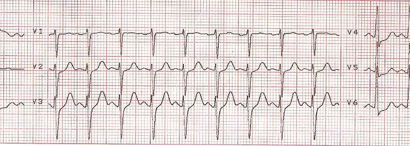 Dr. Rafael Soto - Electrocardiografía - Cardiología clínica ...