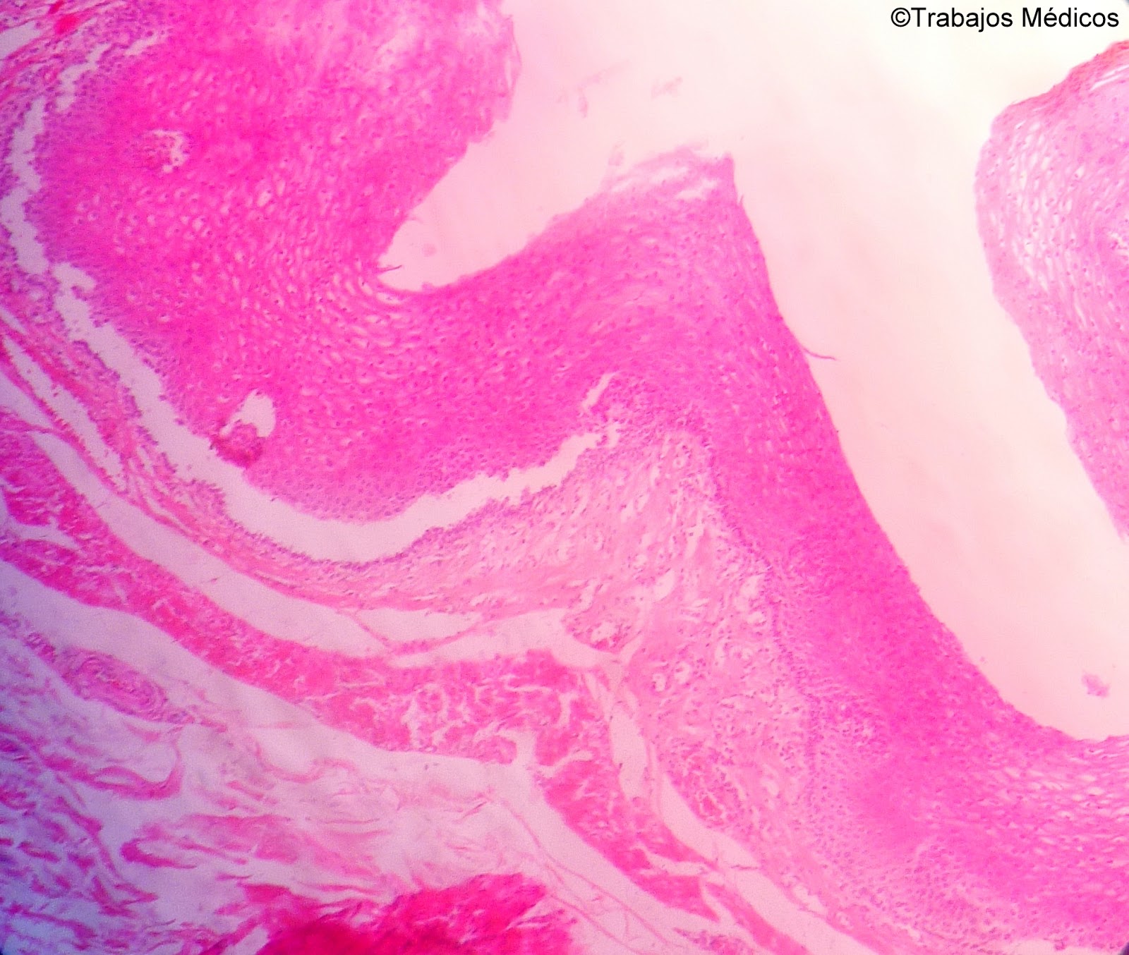 ESÓFAGO - PLACAS HISTOLÓGICAS