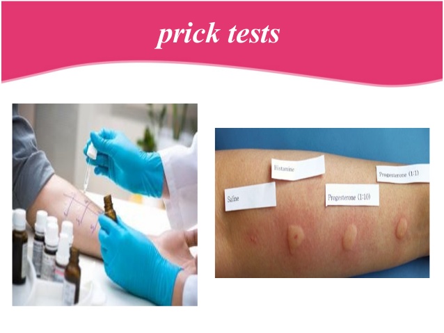 Lecture Notes in Medical Technology: Lecture #: HYPERSENSITIVITY