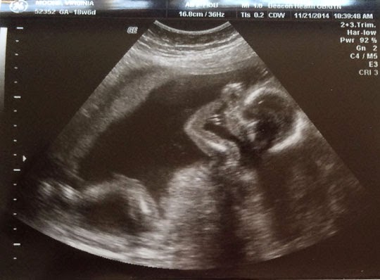 mohaus: Baby #2: 19 Week Ultrasound