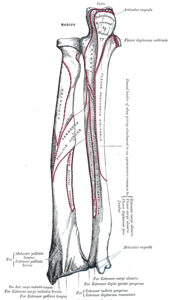 Orthopedmapia: Patah Tulang Radius