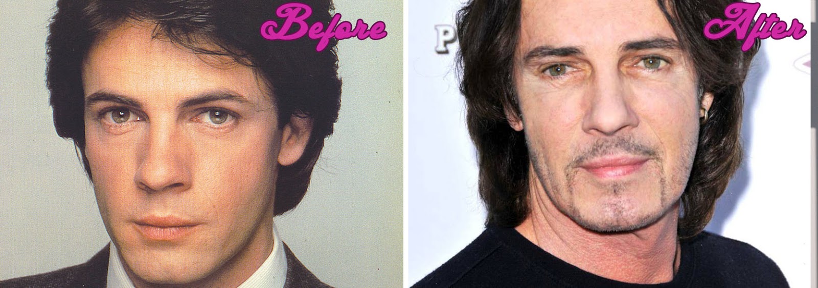 Rick Springfield Plastic Surgery Blog: June 2015