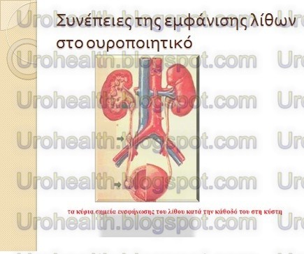 ΛΟΥΤΣΑΡΗΣ ΚΩΝΣΤΑΝΤΙΝΟΣ ΧΕΙΡΟΥΡΓΟΣ ΟΥΡΟΛΟΓΟΣ: ΛΙΘΙΑΣΗ ΟΥΡΟΠΟΙΗΤΙΚΟΥ