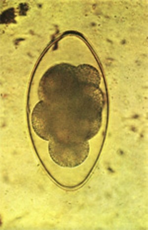 Parasite of the Day: Marshallagia marshalli