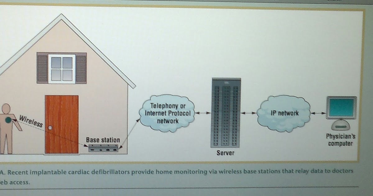 Los Angeles / Monterey Peninsula Targeted Individual (Alda) : DARPA N3 ...