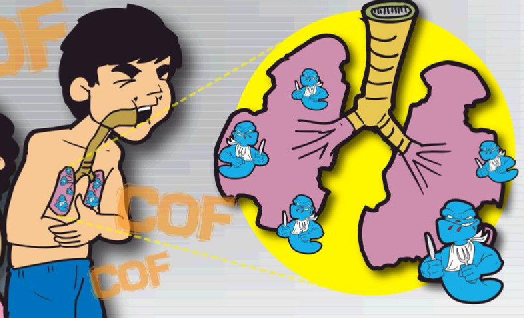 TBC PULMONAR: La Tuberculosis