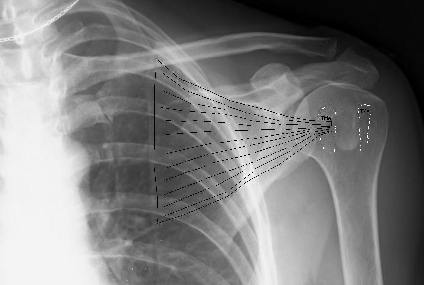 Reumails. Reumatología al día: Resolución de caso ecográfico-radiográfico