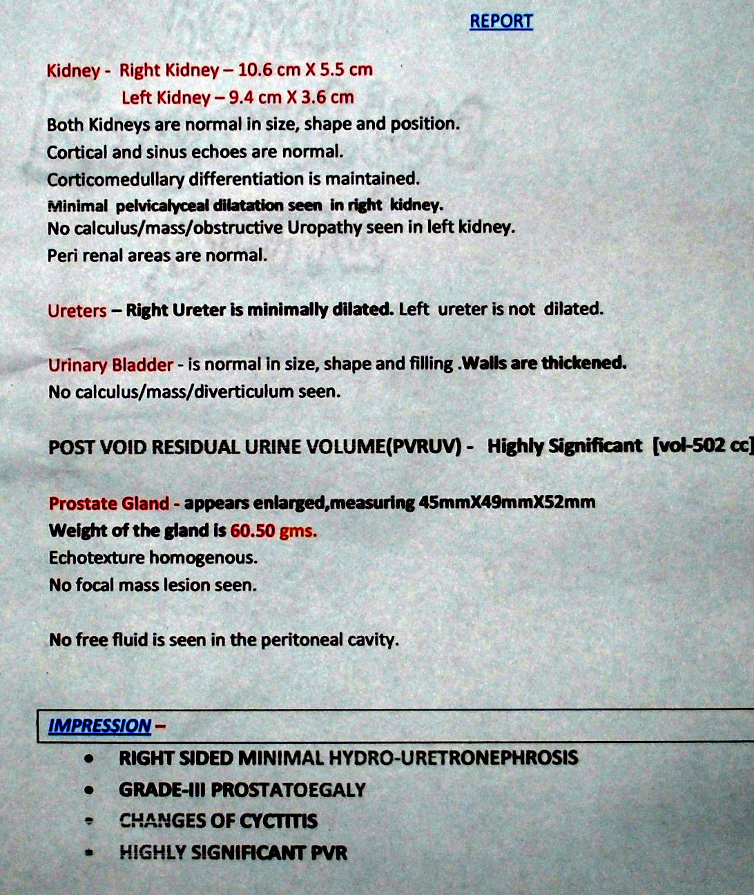 Science Doing: Benign Prostatic Hyperplasia could be Adenocarcinoma ...