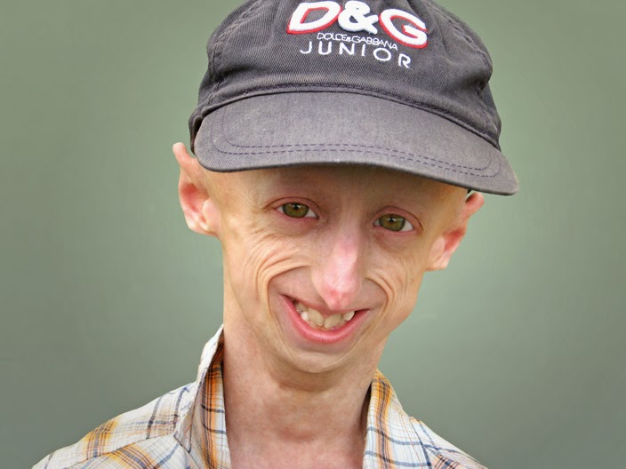progeria family circle: oorzaak