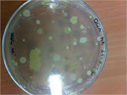 Teknik Isolasi dan Pembenihan Mikroorganisme