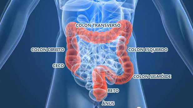 Formas da Retocolite Ulcerativa - Doença de Crohn e Colite Ulcerativa