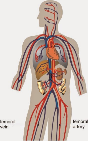 Kesehatan dan Keperawatan: Akses Intravena