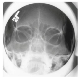 Tema 4. Protocolos radiográficos de cara