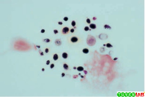 [Microbiology] Atlas of Infections of the Central Nervous System | Free ...