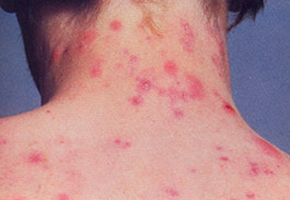 Beauty tip: April 2011