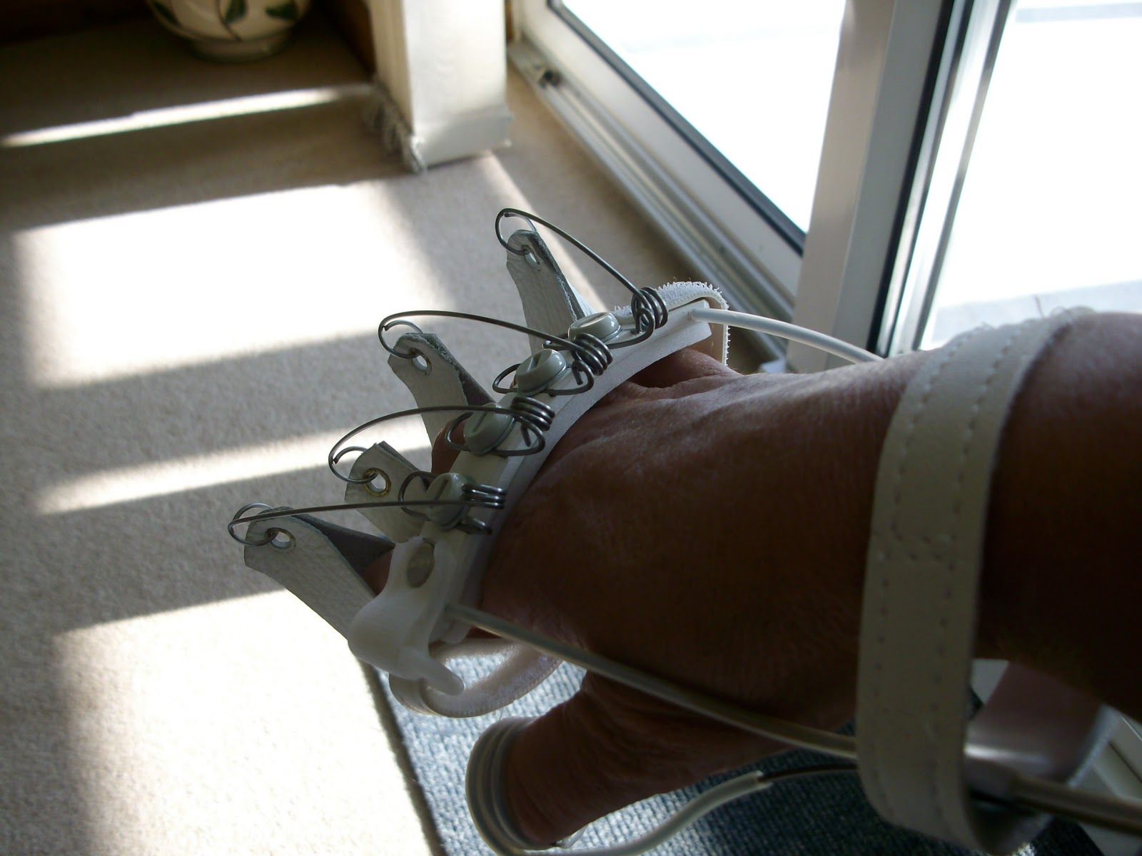 Five Small Minutes: Splints