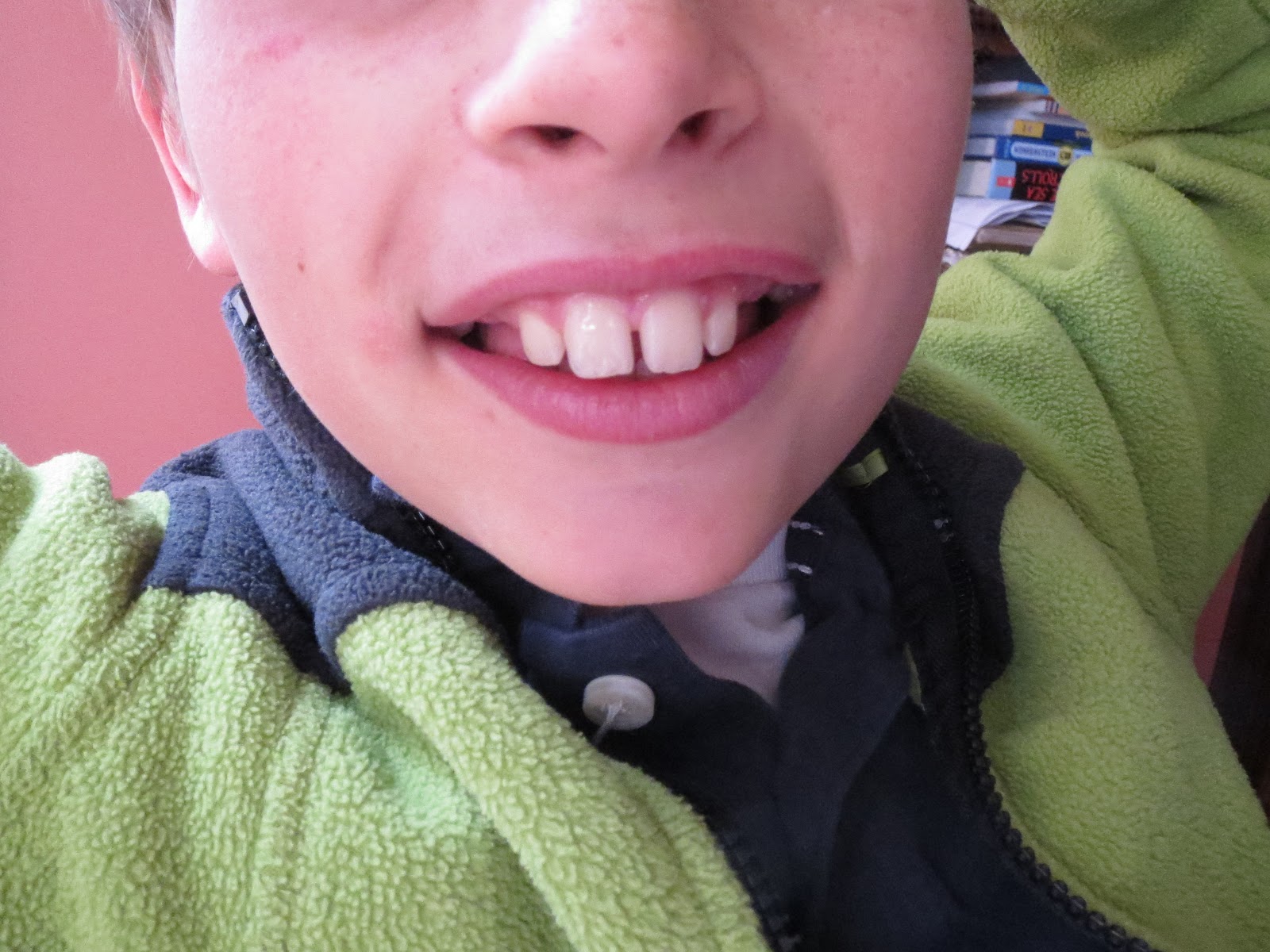 Five Kids in Five Years: Dr Seuss, Teeth, Haircut, B-ball Champion ...