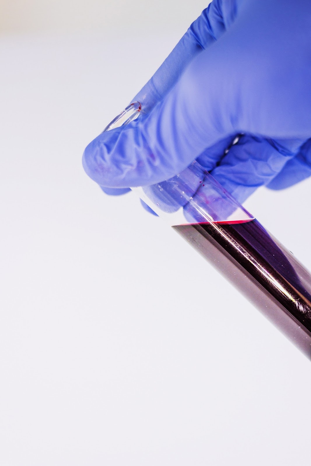 Daniel Gigiano Reviews Daniel Gigiano Reviews DUI Blood Tests daniel-gigiano-reviews-daniel-gigiano-reviews-dui-blood-tests