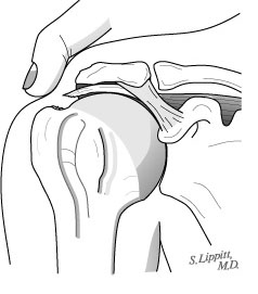 UW Shoulder and Elbow Academy: Rotator Cuff 6 - Clinical examination ...