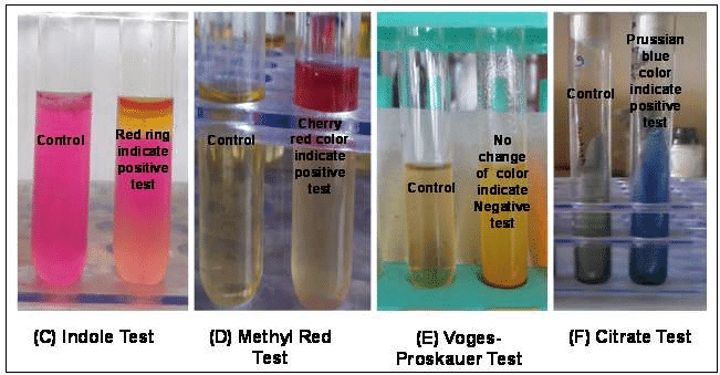 IMVIC TEST (İNDOL, METİLEN KIRMIZISI, SİTRAT, VOGES TEST ...