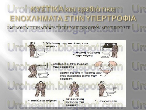 ΛΟΥΤΣΑΡΗΣ ΚΩΝΣΤΑΝΤΙΝΟΣ ΧΕΙΡΟΥΡΓΟΣ ΟΥΡΟΛΟΓΟΣ: ΥΠΕΡΤΡΟΦΙΑ ΤΟΥ ΠΡΟΣΤΑΤΗ