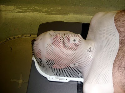 Robin's tonsil cancer blog: Radiation Planning