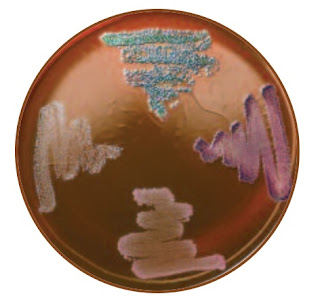 [Microbiology] Eosin Methylene Blue Agar | Free Medical Atlas