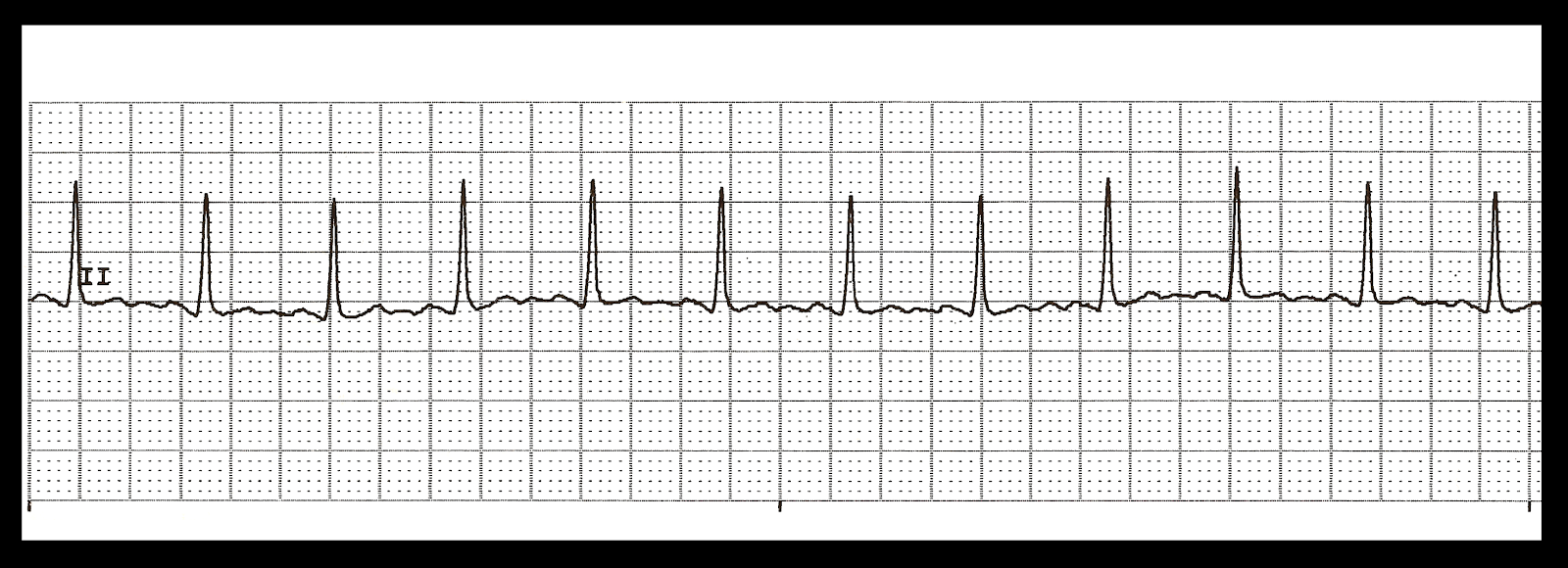 Practice EKG Strips 369