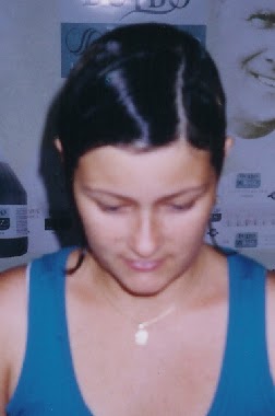 Estética e Beleza: Bulbo Raíz