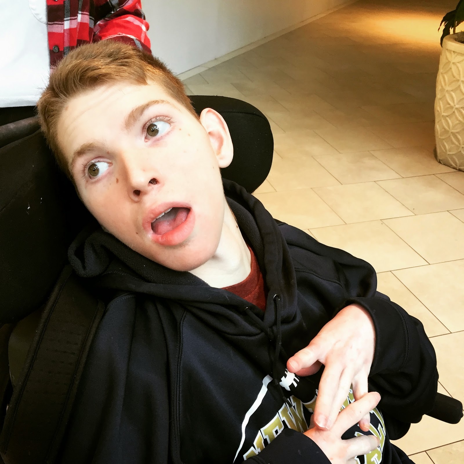 Raising Daniel Hasselberger, a journey with Polymicrogyria: To Baclofen ...