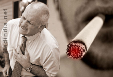 Dampak yang di Akibat oleh ROKOK / MEROKOK ~ PHYSIO KU | Tips Kesehatan ...