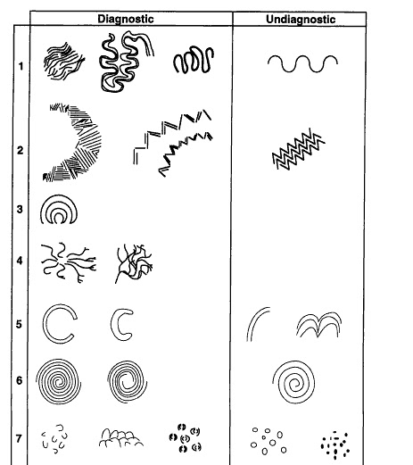 Miri boheme: Textiles and the Multi-Tiered Cosmos: Huari Textiles of Peru