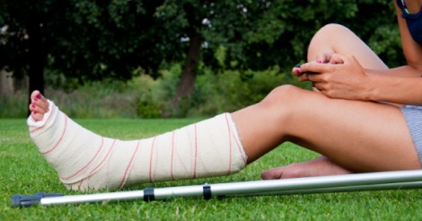 TIPS TULANG PATAH CEPAT SEMBUH DAN BERCANTUM SEMULA