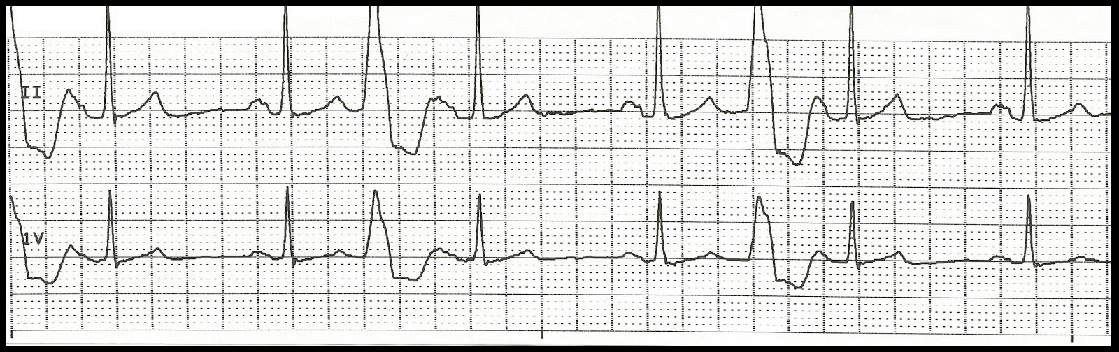 Practice EKG Rhythm Strips 137