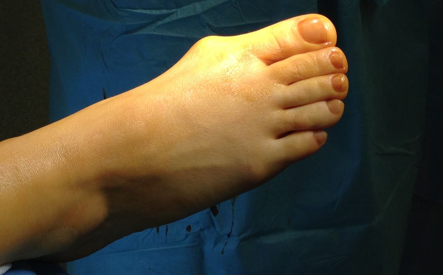 Un Jour En Chirurgie Orthopedique Et Traumatologique: Prise en charge d ...