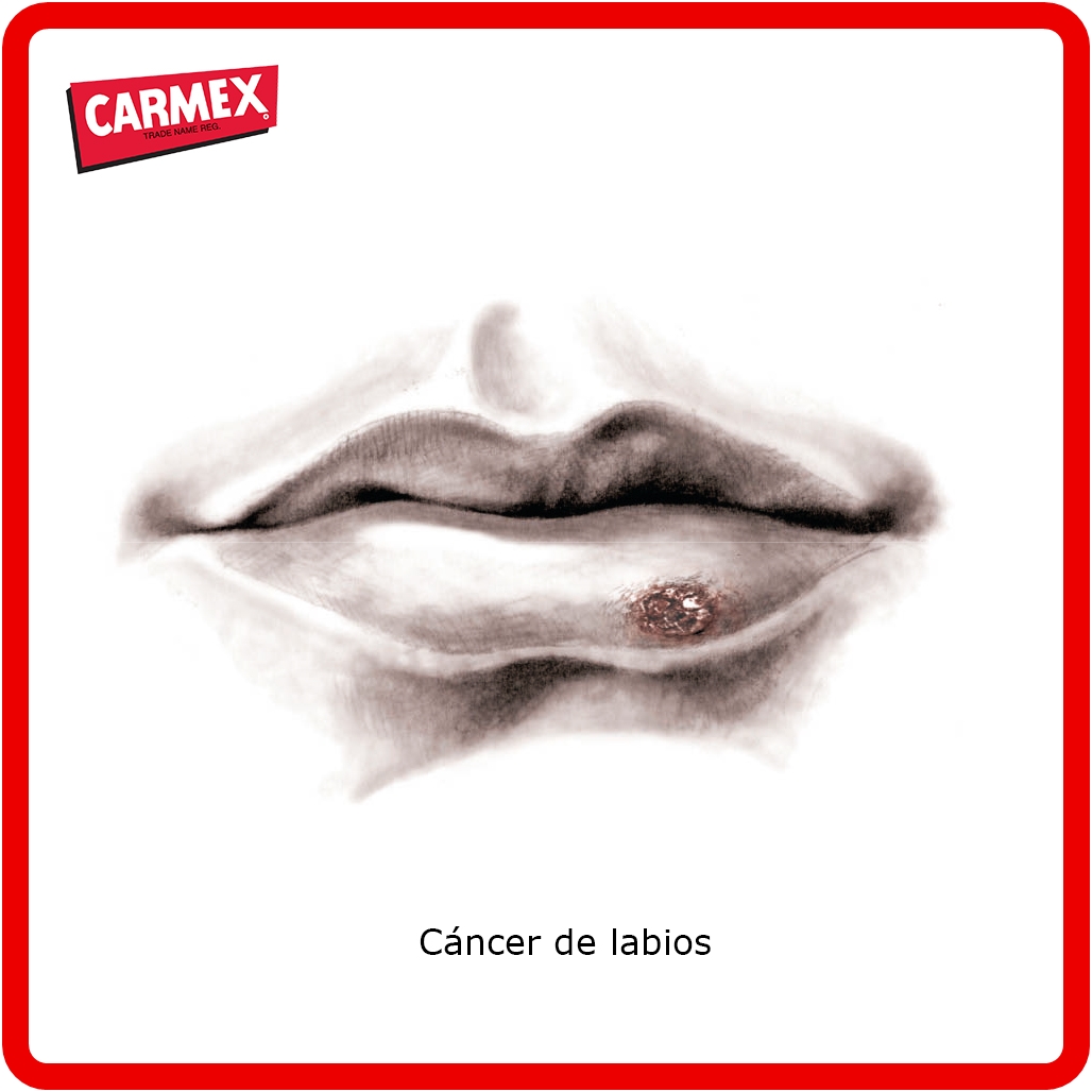 LipBook: Cáncer en los labios