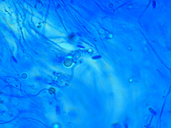 Fun With Microbiology (What's Buggin' You?): Sarocladium kiliense