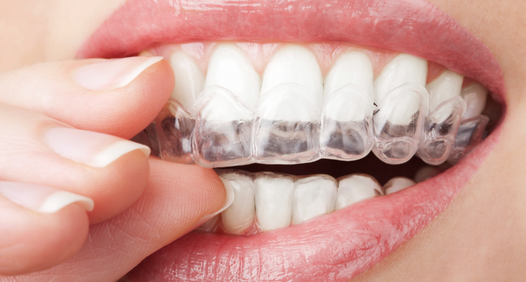 Dr.George E. Bardawil-Orthodontist-Invisalign Diamond level : Dr ...