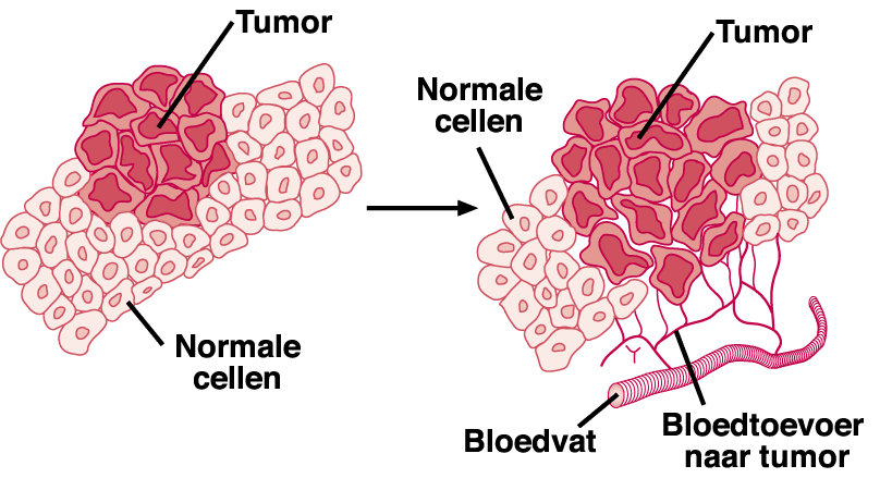 Apa itu Kanker? (Cancer) - Terbarutau