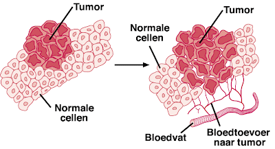Apa itu Kanker? (Cancer) - Terbarutau