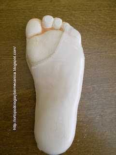 Ortopodologia y Biomecanica : “GAIT PLATE”. TRATAMIENTO METATARSO ADUCTO