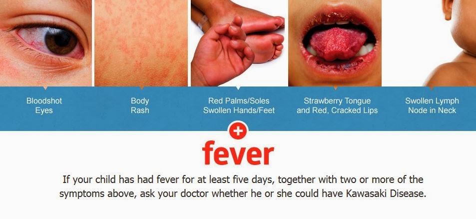 Smith and Blessings: Kawasaki Disease Awareness Day!