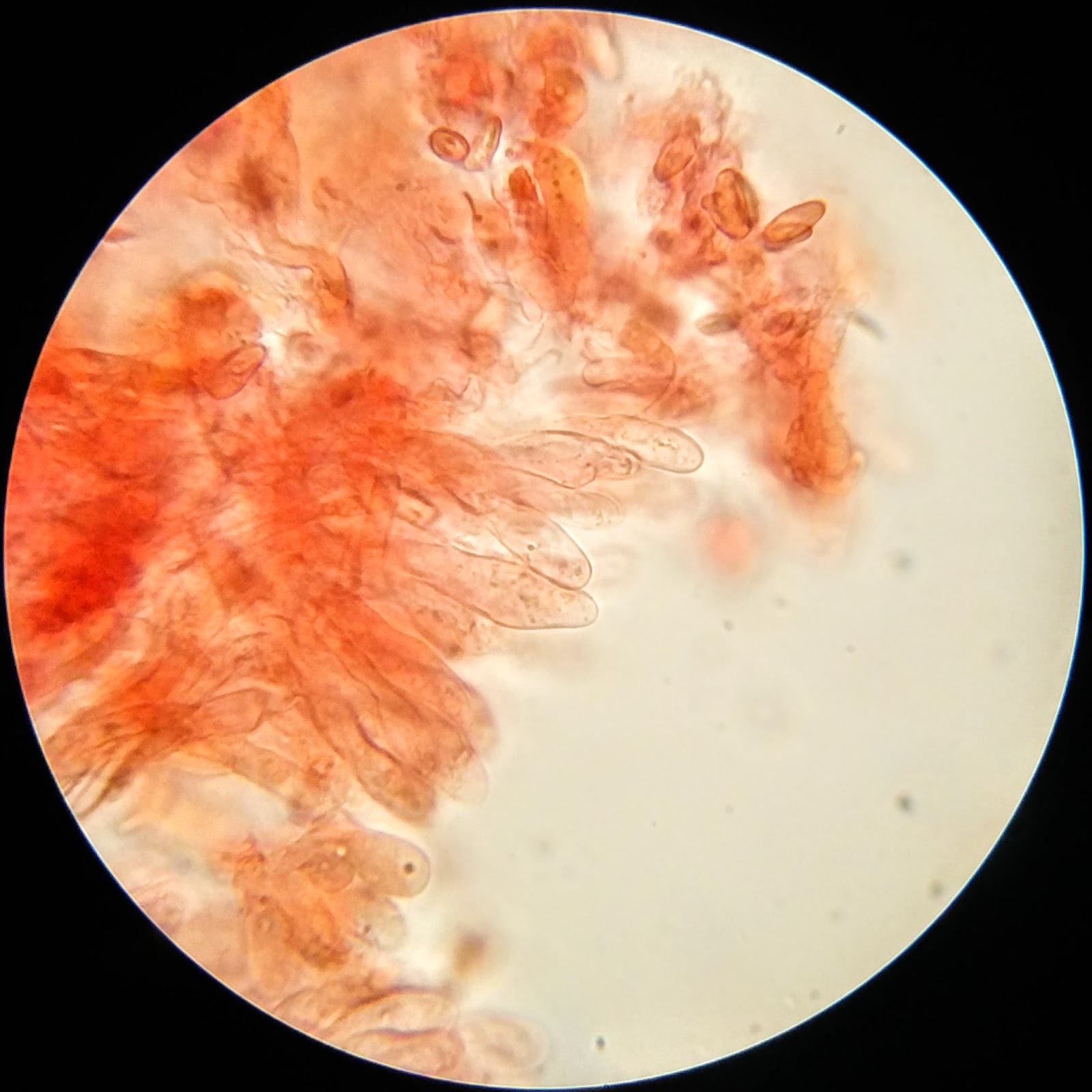 Misidentifying Fungi: Another load of Lepiotas