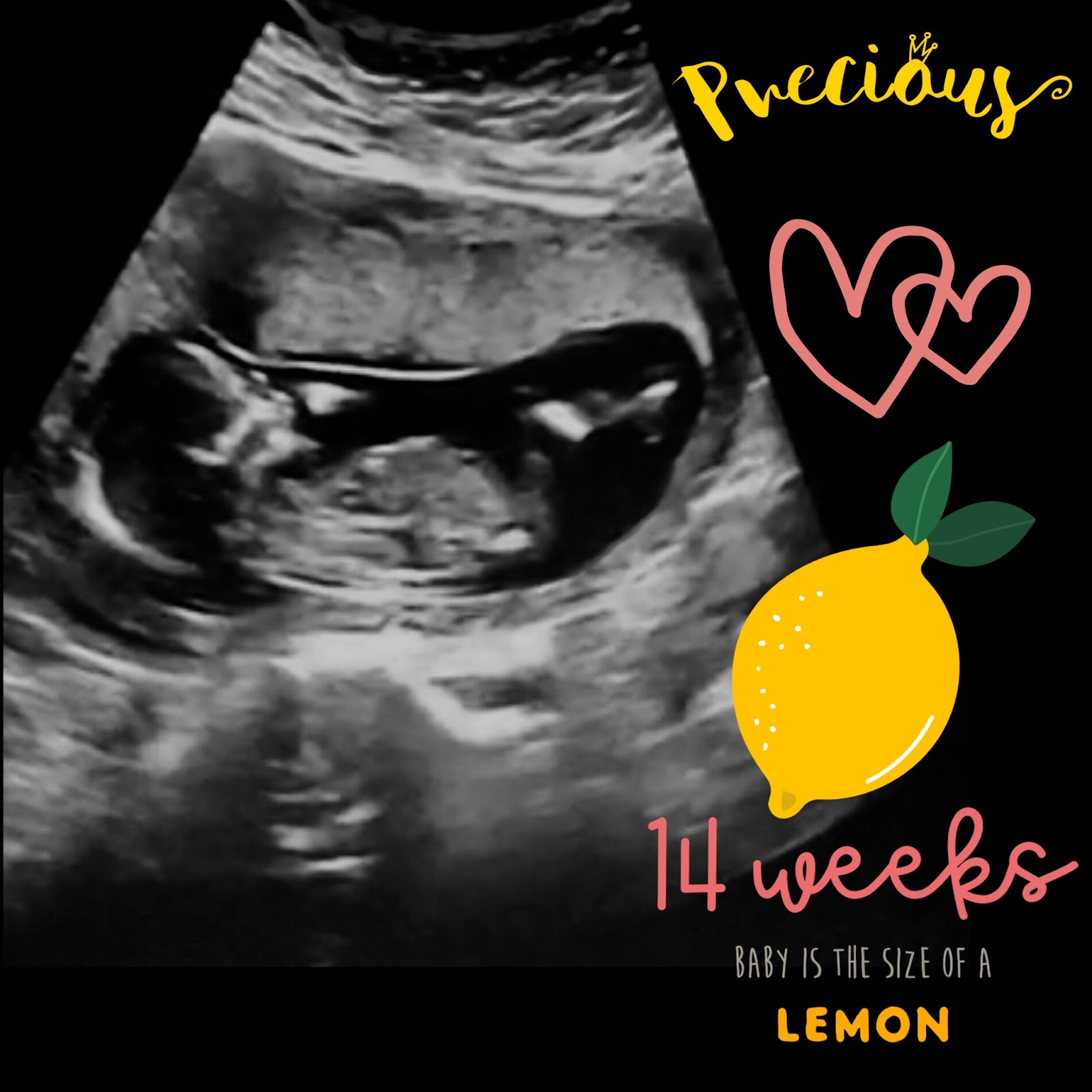 Journey To Baby Jaju: 14 weeks.... We are in the safe zone