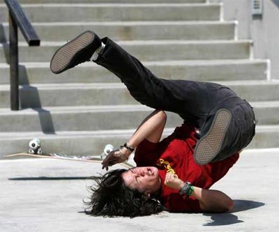Skate Board: INJURY