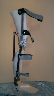 Prosthetics & Orthotics from My Care: Calipers for Polio Patients (KAFO)